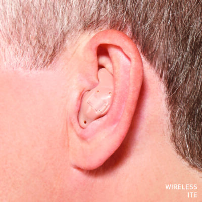 In The Ear (ITE) Full Shell Hearing Aids | Integrate Hearing Stockport ...